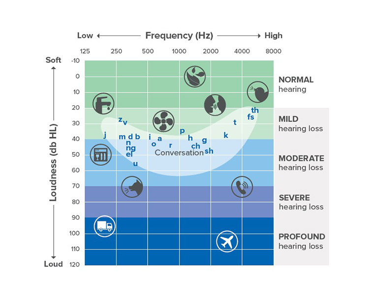 Audiograms – What Is An Audiogram & How To Understand It